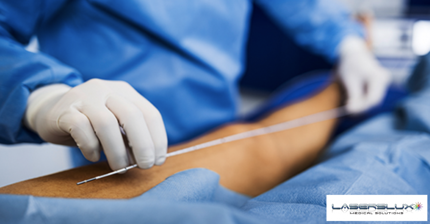 EVLT - TRATAMIENTO LASER ENDOVASCULAR