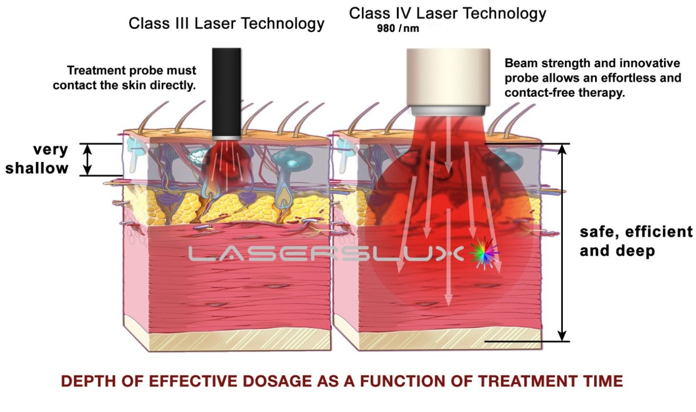 Laser terapeutico para Podologia de alta intensidad. - LasersLux ...